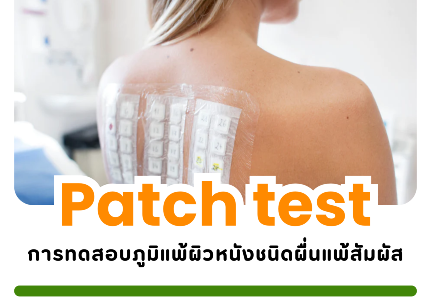 หมดปัญหาผื่นแพ้แบบไร้สาเหตุ เริ่มต้นด้วย “Patch Test” – ศูนย์บริการทาง ...